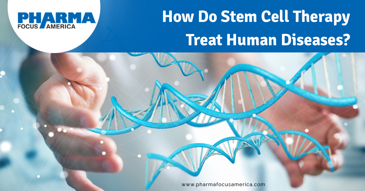 How Do Stem Cell Therapy Treat Human Diseases?